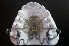 Pendulum – KFO – Team und Technik