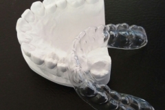 Retentionsschiene – KFO – Team und Technik